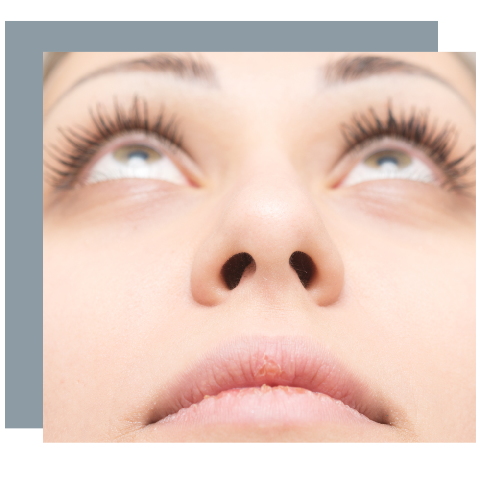 Sinusite et polypose naso-sinusienne - Dr Benjamin Pescetto