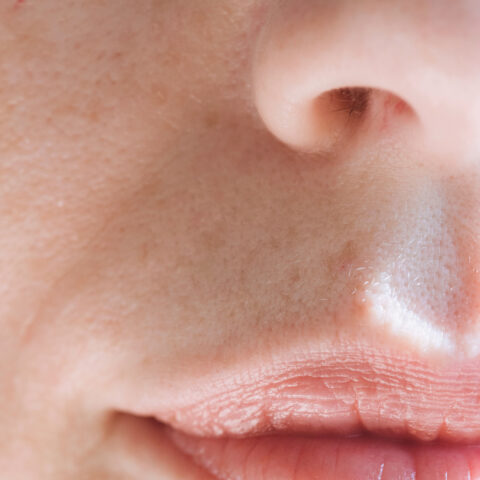 Sinusite et polypose naso-sinusienne - Dr Benjamin Pescetto